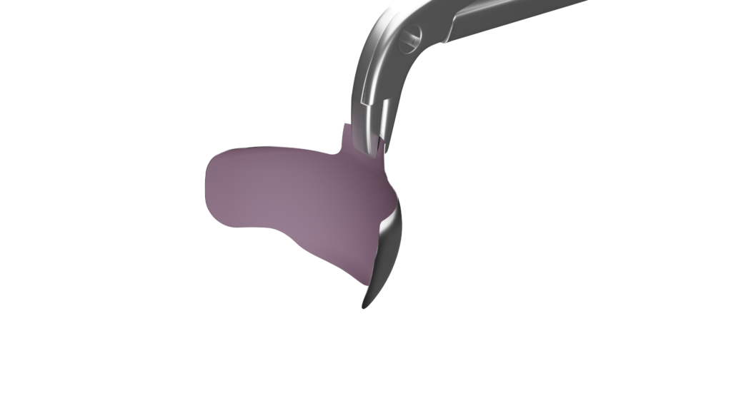 GARRISON Strata-G™ Matrix Bands - DF Dental Solutions